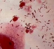 trophigil – Miss Frottis